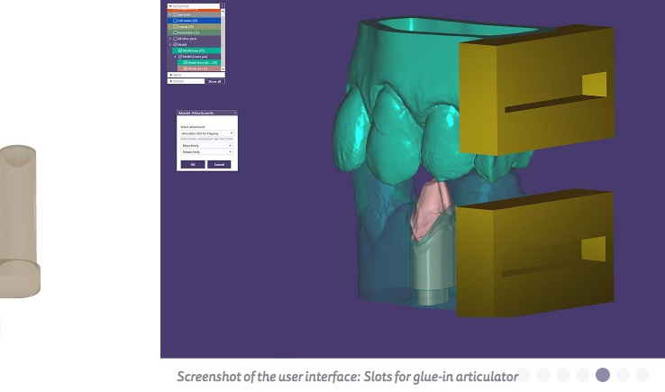 Exocad | DD Model creator - PX Dental