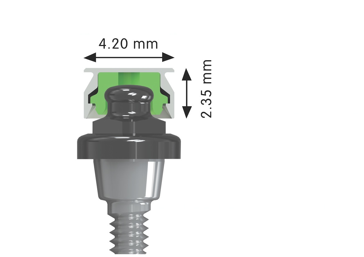 Optiloc | Abutments - PX Dental
